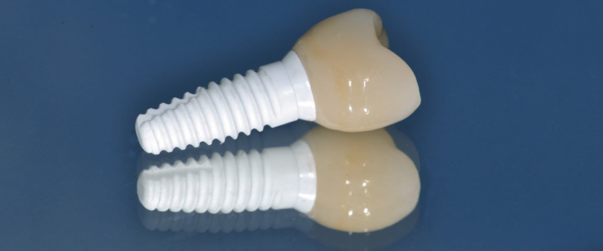 Ceramic implants - exotic or a useful addition to the treatment ...